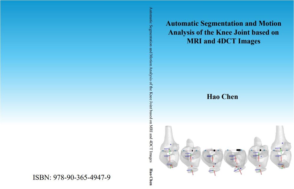 Phd Defence Hao Chen Automatic Segmentation And Motion Analysis Of The Knee Joint Based On Mri
